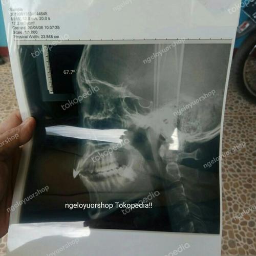 Jual paper yc film inkjet Rontgen paper film ronses A4 - Kota Depok ...