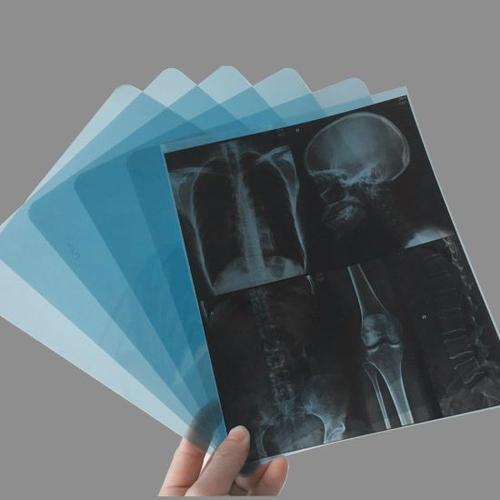 Jual Medical Dry Film Radiologi - Blue Film Inkjet Rontgen - Satuan A4 ...