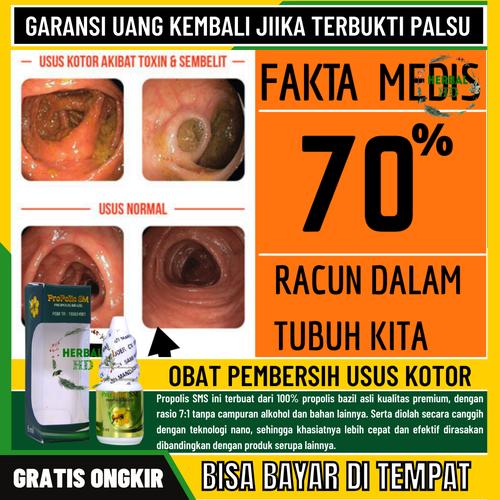 Jual Obat Herbal Pembersih Usus Kotor, Infeksi Usus, Usus Besar, Usus ...