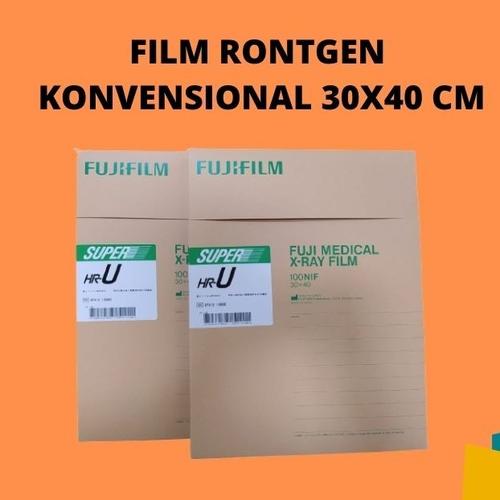 Jual FILM RONTGEN 30X40 CM / RADIOLOGI - Jakarta Pusat - Alat Kesehatan ...
