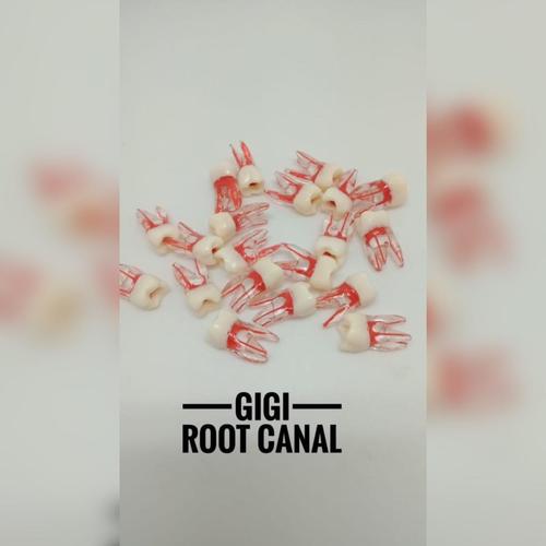 Jual Gigi Endodontik dengan Saluran Akar (Model Gigi Root Canal ...