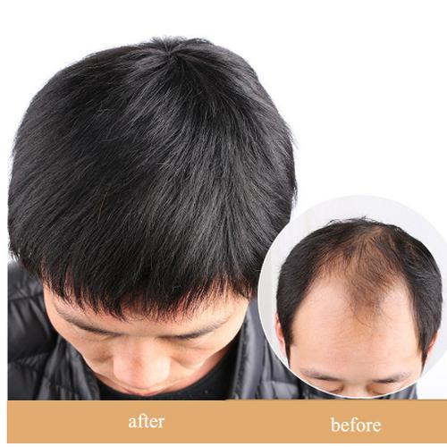 Jual Wig Pria - Penutup kepala Botak - Wig Kepala Botak - Jakarta Barat ...