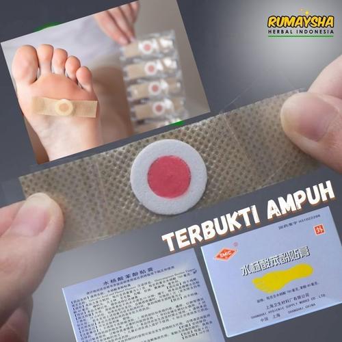 Jual Plester Kutil Mata Ikan Caplak Kapalan Penghilang Kutil SMIC ...