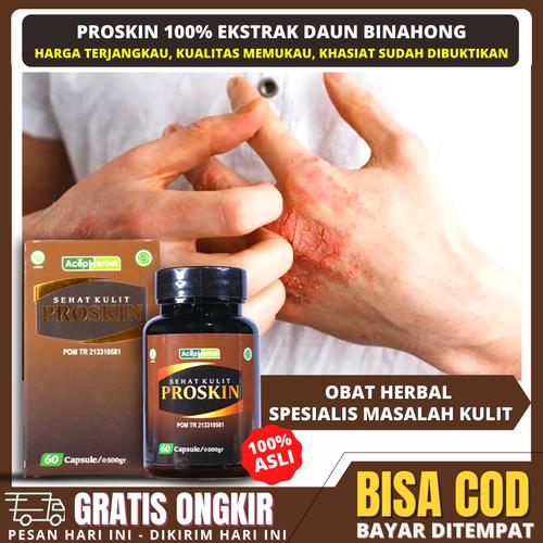 Jual Proskin Isi 60 Kapsul - Obat Kulit Dermatitis Seboroik Atopik ...