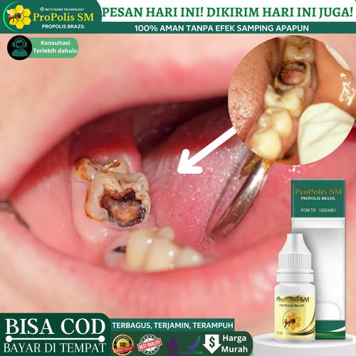 Promo Obat Radang Gusi Bengkak Karena Gigi Berlubang, Obat Sakit Gigi Ngilu - Jakarta Timur ...