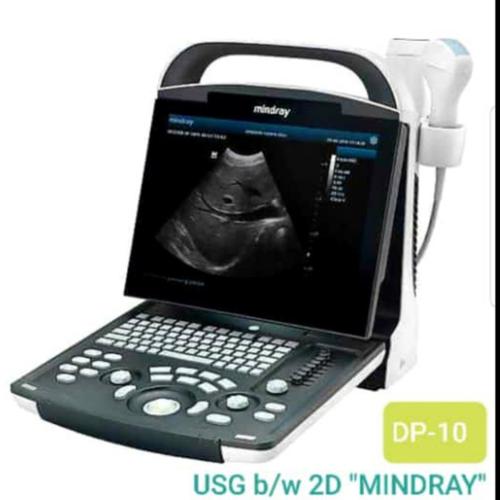 Jual usg 2d mindray dp10 / USG DP 10 mindray new version black edition ...