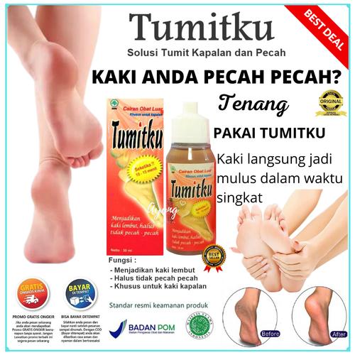 Promo Tumitku Obat Herbal Kaki Pecah Pecah Kapalan Kaki Instan Original ...