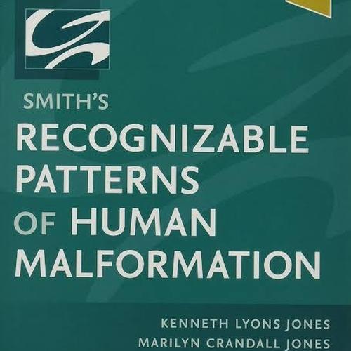 Jual Smith Recognizable Patterns of Human Malformation - isi Hitam ...