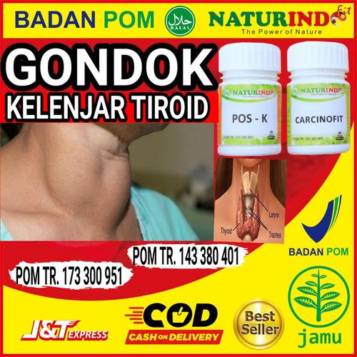 Jual Obat Gondok Beracun Tiroid Di Leher Kelenjar Tiroid Hipertiroid ...
