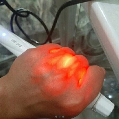 Jual Vein Finder Bestman,Alat Pencari Nadi Tangan,Alat Deteksi Nadi ...