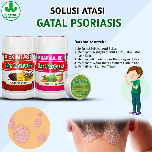 Jual Obat Gatal Psoriasis Jamur Tinea Kulit Bersisik Berkerak di Kepala ...