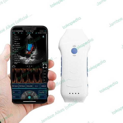 Jual USG Wireless/WiFi (ECHO Ultrasound) (linear+Cardiac Sector Probe ...