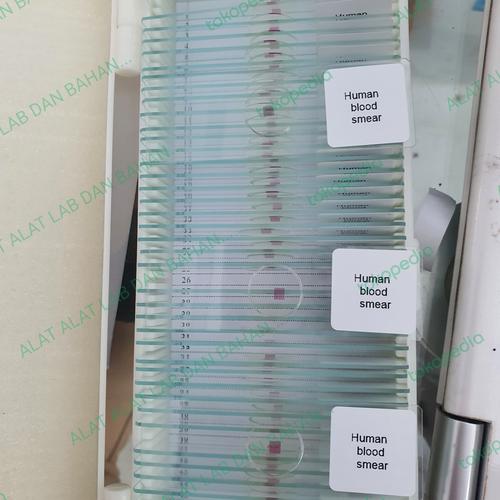 Jual Preparat Slide Darah (Blood Slide)/ Blood Smear - Blood Slide ...