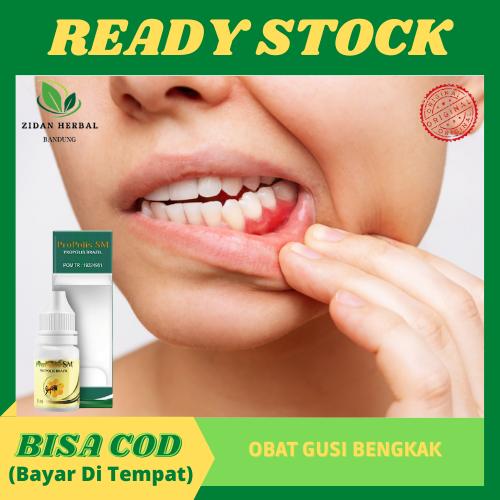 Jual Obat Gusi Bengkak Radang Gusi Berdarah Bernanah Abses Gusi - Kota ...