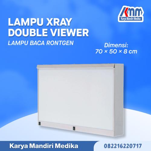 Jual Lampu Xray Double Viewer | Lampu Baca Rontgen Diruangan Radiologi ...