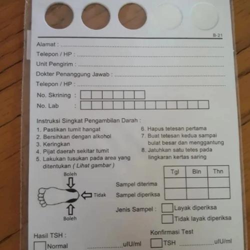 Jual Kertas Saring SHK ( Satuan ) Skrining Hipotiroid - Lubang 3 - Kota ...