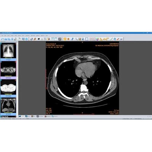 Jual Sante DICOM Viewer 3D Pro v4.9.4 + Sante DICOM Viewer Pro v14.0.2 ...