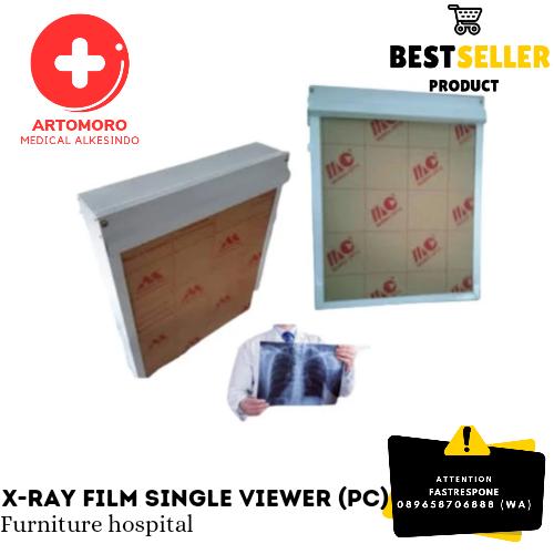 Jual alat bantu baca foto rontgen X Ray film medis single PC - Kab ...