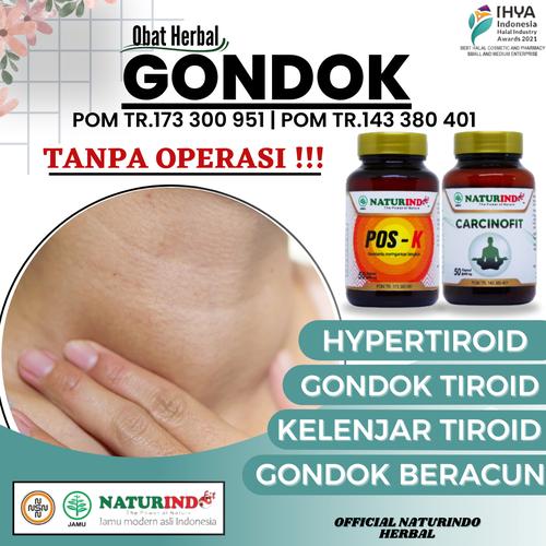 Jual Obat Gondok Hypertiroid Kelenjar Tiroid Gondok Beracun Benjolan Di ...