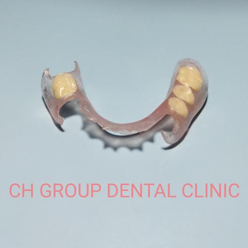 Jual Plat Gigi Palsu Flexible Lepasan (Valplast) - Kota Medan ...