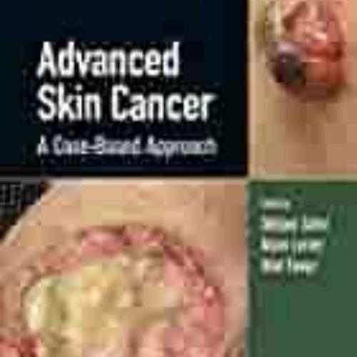 Jual [Full Color] Advanced Skin Cancer - isi Full Color - Kota Bandung ...