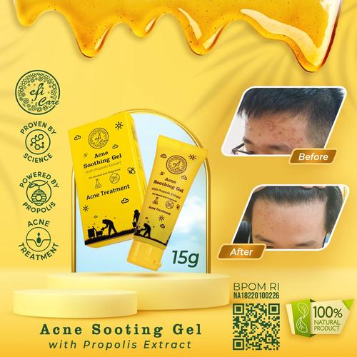 Jual EfiCare Propolis Acne Treatment by Kebun Efi - 30 gram - Jakarta ...