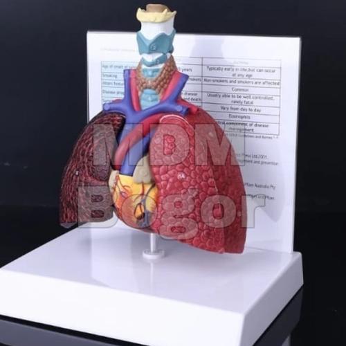 Jual Alat Peraga Paru-Paru Manusia Model Anatomi Sistem Pernapasan ...