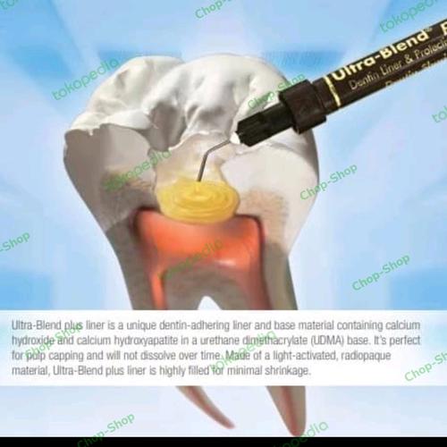 Jual ORIGINAL Ultradent Ultrablend Plus Syringe 1,2 ml liner pulp capping - Dentin Shade - Kab ...