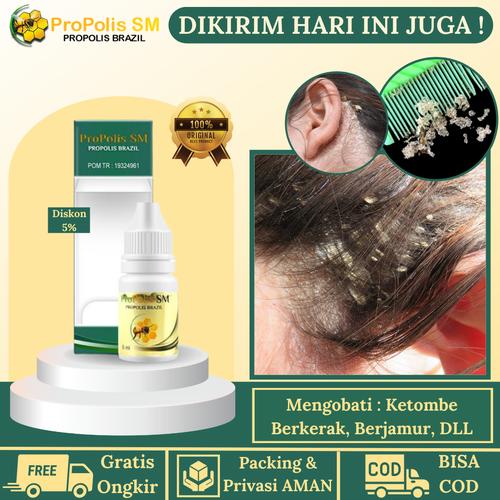 Promo Obat Ketombe Berkerak Di Kepala, Penghilang Ketombe Parah Bagus - Jakarta Timur - Propolis ...