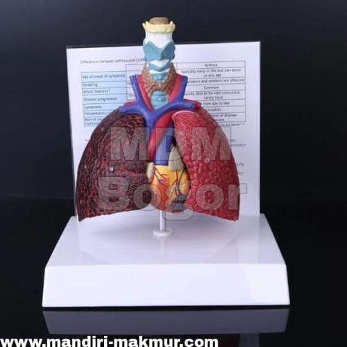 Jual Alat Peraga Paru-Paru Manusia Model Anatomi Sistem Pernapasan ...