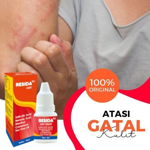 Jual Obat Panu Gatel Kulit Cair Resida SC Paling Ampuh 100% Original ...
