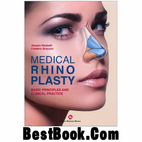 Jual ORIGINAL MEDICAL RHINO PLASTY BASIC PRINCIPLES AND CLINICAL ...