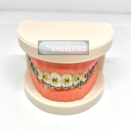 Jual Model Gigi Ortho Study Model Ortodonti Edukasi Model Behel Gigi ...