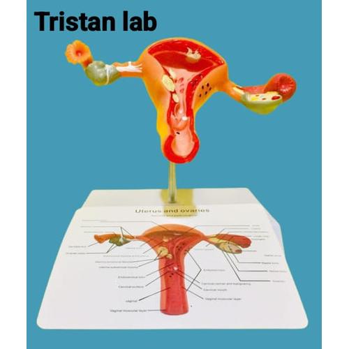 Jual Alat Peraga Uterus and Ovaries/ Anatomi Rahim ( Normal ...
