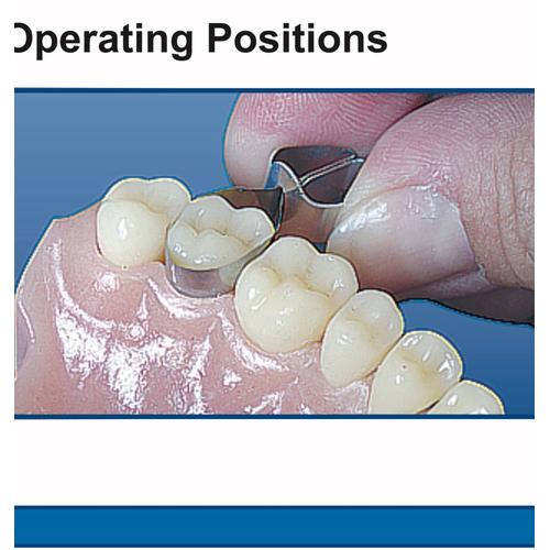 Jual Dental Matriks Pre molar / Premolar matrix - Jakarta Timur ...