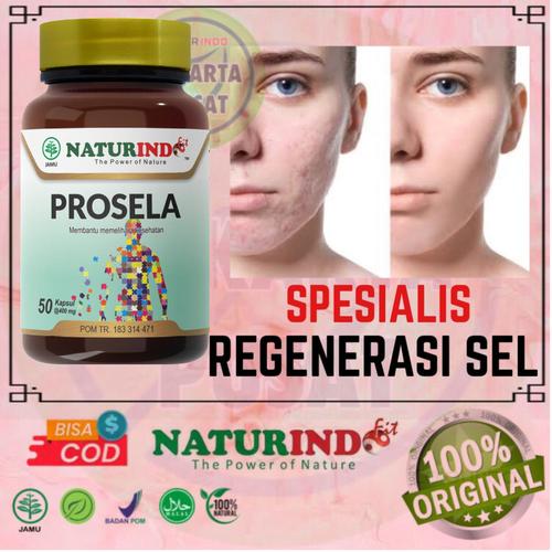 Jual Naturindo Prosela Obat Herbal Bopeng Penghilang Bekas Jerawat Pria ...