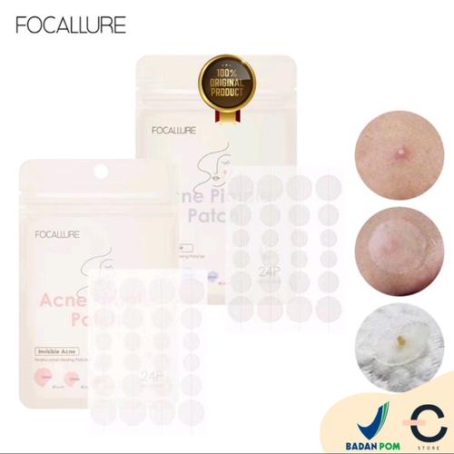 Jual FOCALLURE Spot patch Acne treatment Day/Night FA-186 BPOM ...