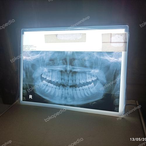 Jual Lampu baca rontgen viewer film ronsen A4 slim - Kota Depok ...
