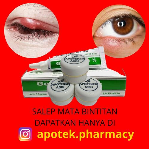 Jual Salep Obat Mata Bintitan Benjolan Mata Racikan Apoteker Asri ...