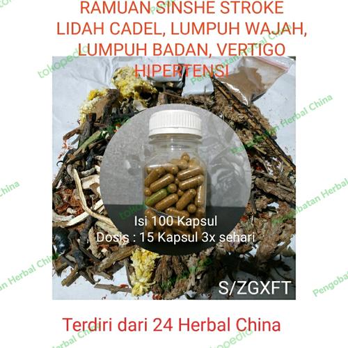Jual Obat Sinshe Stroke,Lidah Cadel,Lumpuh Wajah Badan,Vertigo ...
