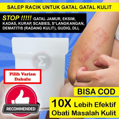 Jual OBAT SALEP EKSIM KERING AMPUH BASAH GATAL GATEL KULIT PANU KURAP ...