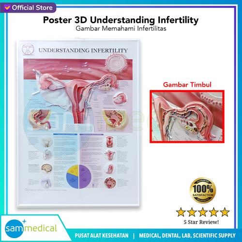 Jual Poster 3D Anatomical Understanding Infertility BS 123RR - Kota ...
