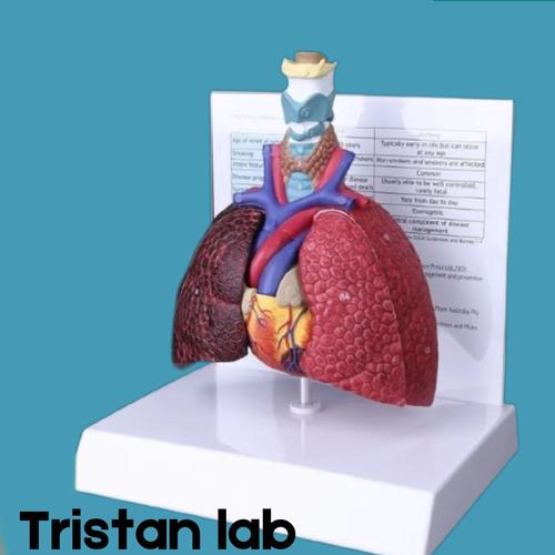 Jual Alat Peraga Paru-Paru Sistem Pernapasan Model Anatomi Manusia ...