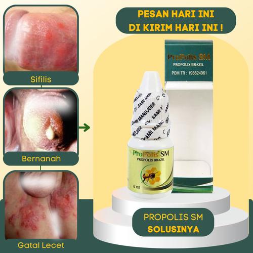 Jual Salep sipilis sifilis spilis gonore kencing nanah kelamin lecet ...