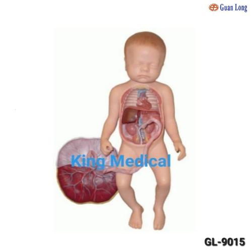 Jual Alat Peraga/Phantom Fetal Circulatory System Placenta GL 9015 ...