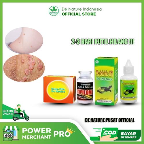Jual Cream Anpiloma dan salep djie/Plus obat kutil papiloma Ampuh ...
