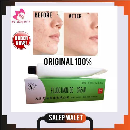 Jual Fluocinonide Cream Salep Walet Atasi Flek Hitam Jerawat Gatal Bisa ...
