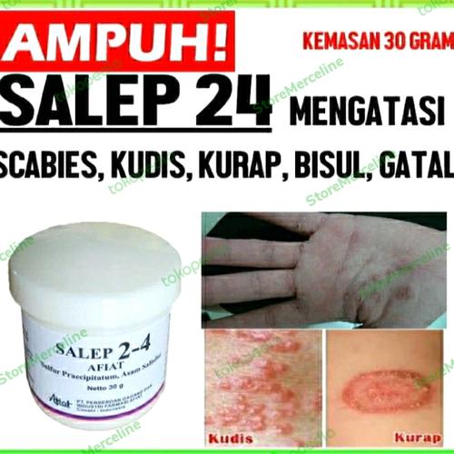 Jual salep gatal scabies kudis parasit kutu air 30gram - Kab. Sidoarjo ...