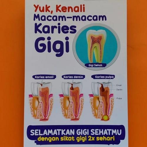 Jual Poster karies gigi bahan ivory 230 gram / poster kedokteran gigi ...