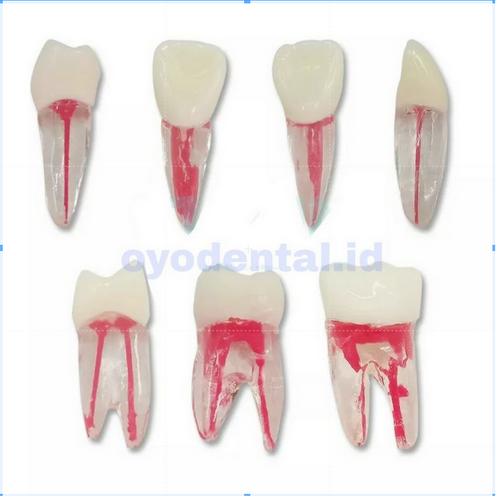 Jual Dental artificial teeth endodontic model gigi endodontik saluran ...